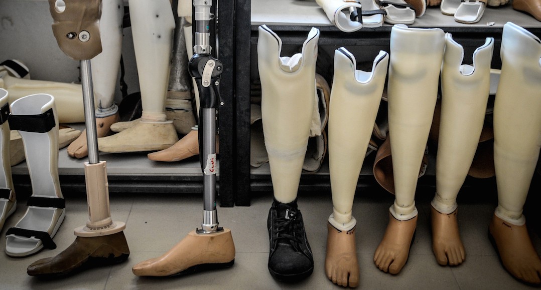 Cette prothèse de jambe permet aux amputés d'avoir à nouveau des ...