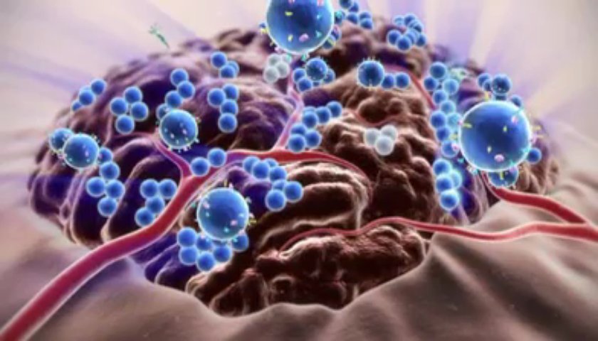 Cancer de la vessie : une percée dans le traitement du cancer avancé ...